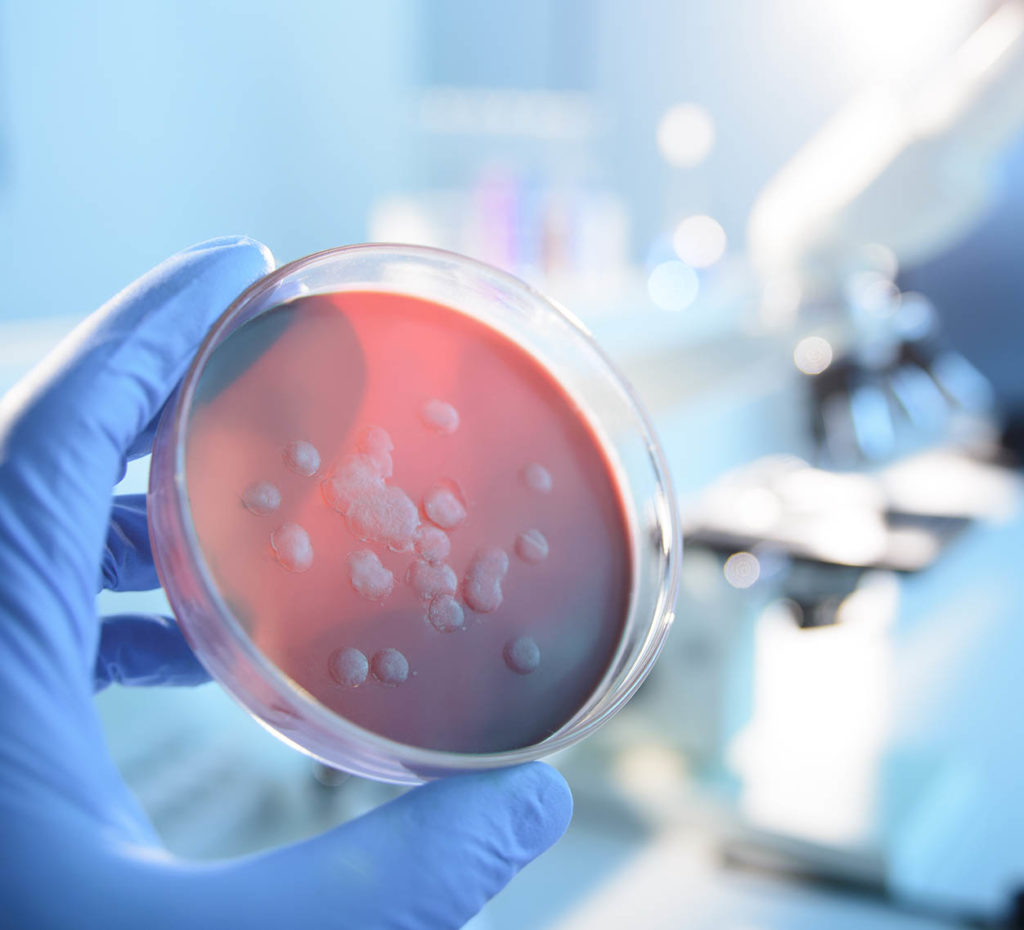 Infectious Disease Research - Wayne State University: School of Medicine